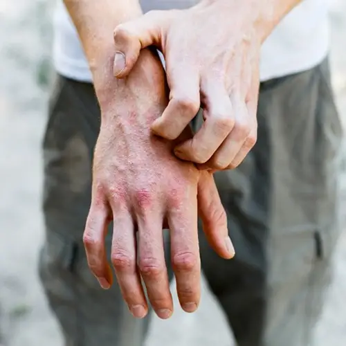 How To Keep Dry Hands Hydrated & Soft: Treatments & Advice | CeraVe UK